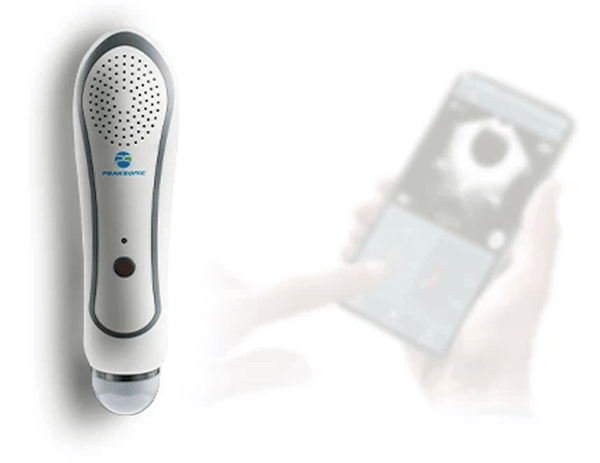 Peaksonic M3 Hand-Held BladderView Scanner | InterAktiv Health
