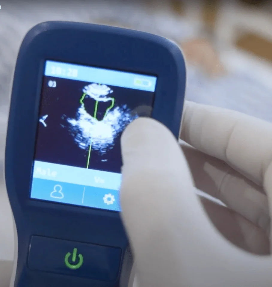 Peaksonic BladderView 3D Hand-Held portable Scanner-InterAktiv Health